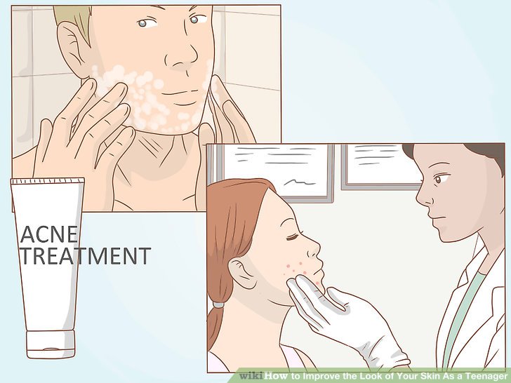 How to get rid of acne during puberty at home – Kallos