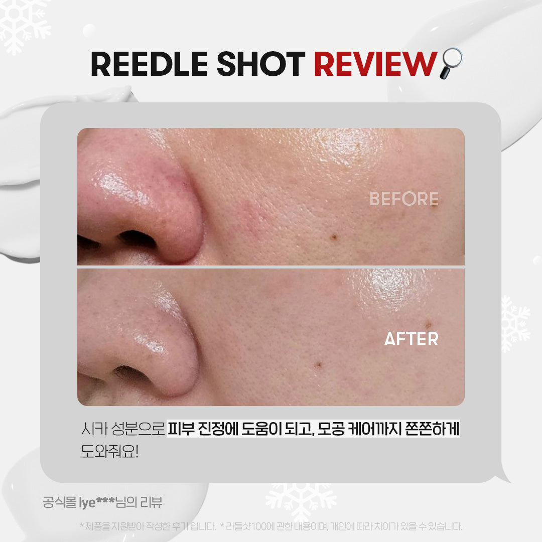 Tinh Chất VT Reedle Shot 300 Essence – Kallos